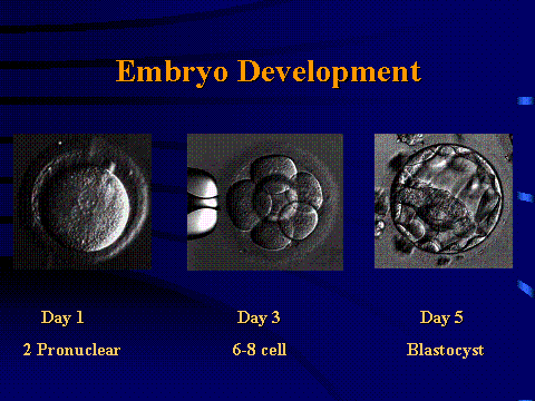 Blastocyst transfer - Conceive IVF